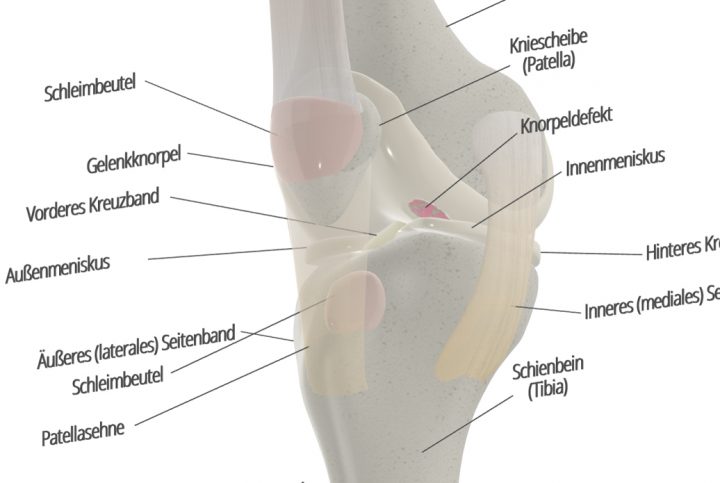 Knie Wiki Begriffe rund ums Knie einfach erklärt | Knorpelexperte.de