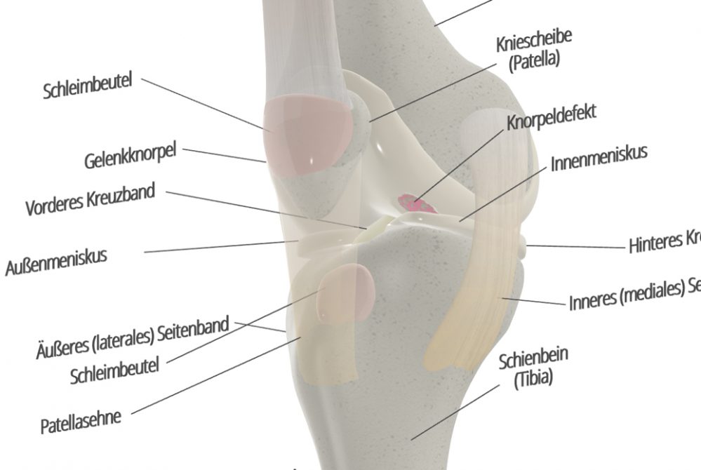 Knie Wiki Begriffe rund ums Knie einfach erklärt | Knorpelexperte.de